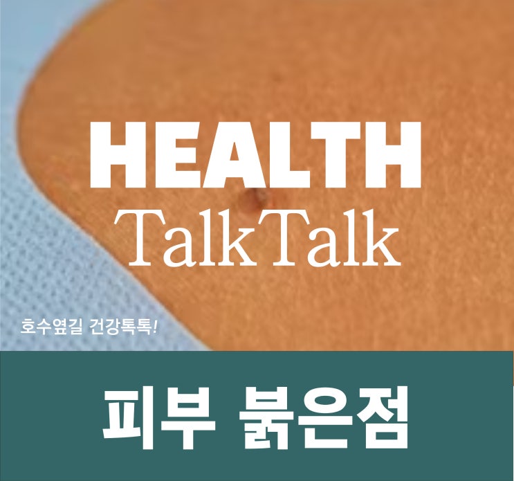 피부 붉은반점 원인 4가지 네이버 블로그