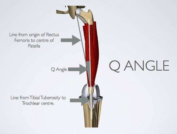 강아지 슬개골 탈구 Q ANGLE 이란? : 네이버 블로그