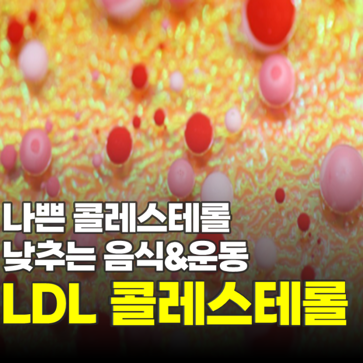 Ldl 콜레스테롤 낮추는 방법 음식 운동 총정리 네이버 블로그