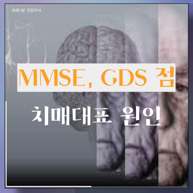 MMSE 점수 검사 GDS 치매대표 원인 : 네이버 블로그