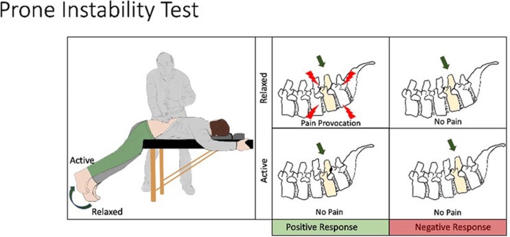 Prone Instability Test 허리가 아파요! 허리에서 소리가 나요! 이럴 때 알아볼 수 있는 검사 : 네이버 블로그