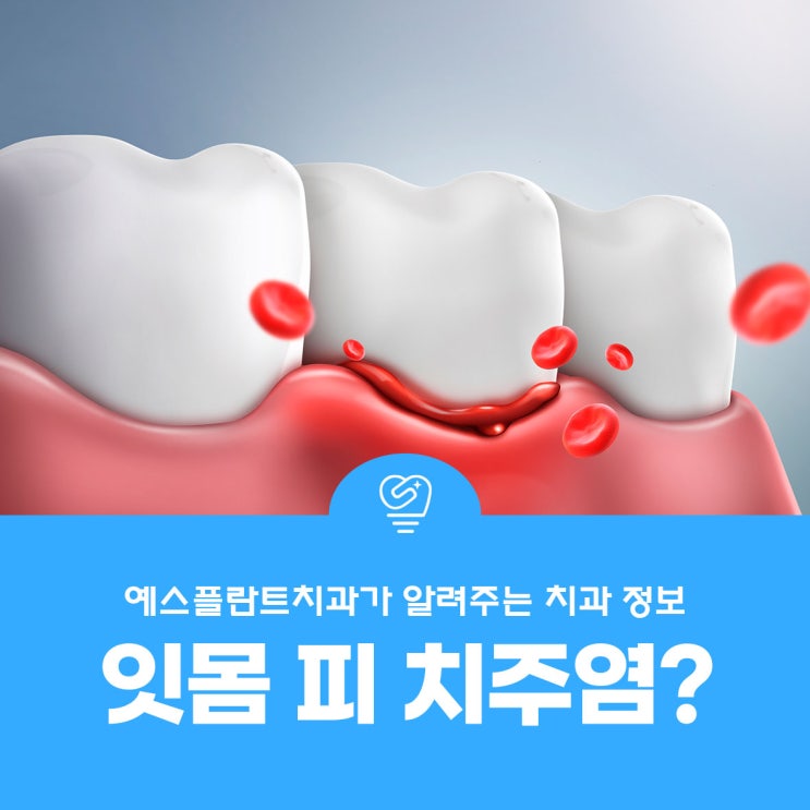 고잔역잇몸치료 치주염 증상 원인 알아볼까요 네이버 블로그