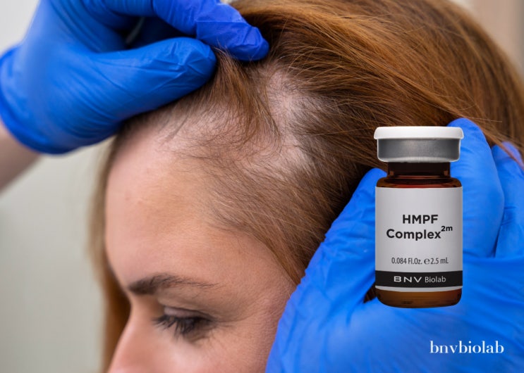 비엔뷔 바이오랩(bnv biolab) HMPF mts 모낭성장인자 앰플 소개해요 : 네이버 블로그