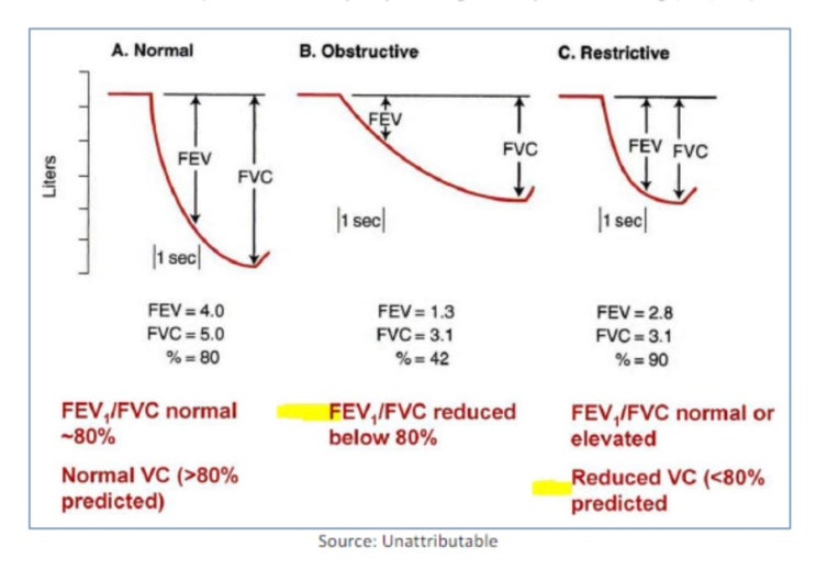 의학용어 FEV1/FVC, TLC, FRC, TV 공부하기 : 네이버 블로그