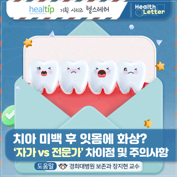 치아 미백 후 잇몸에 화상‘자가 Vs 전문가 차이점 및 주의사항 네이버 블로그