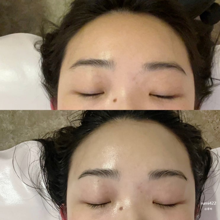 대구 북구 에스테틱 구암동 피부관리 잘하는 대구 힐링하우스 솔직후기 네이버 블로그