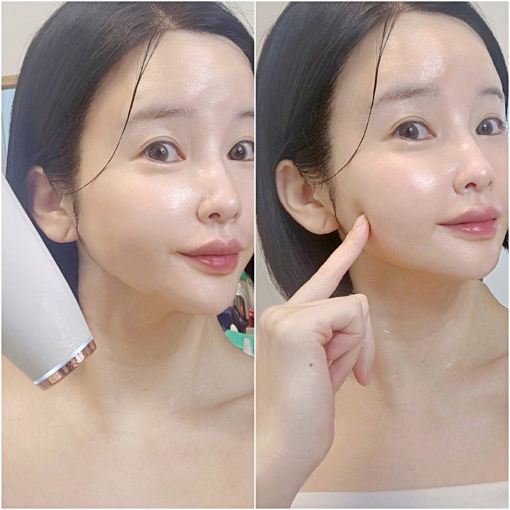 뷰티 디바이스 알록 울트라체인지 피부탄력 속부터 겉까지 잡아주는 리프팅기기 추천 네이버 블로그