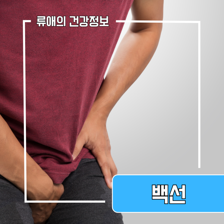 사타구니 백선 증상 및 원인 사타구니 곰팡이 가려움 문제 네이버 블로그