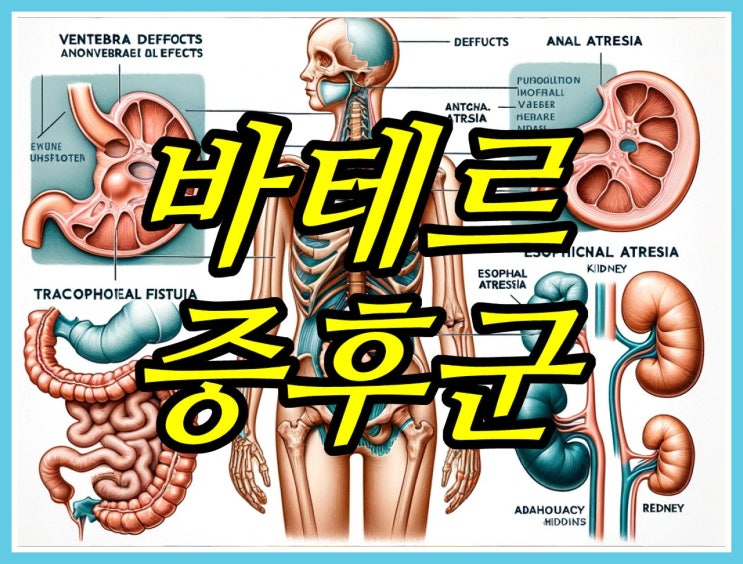 바테르증후군 원인은 임신 유전자 척추 항문 신장 요골 심장 기형 증상 치료가 필요해요 네이버 블로그