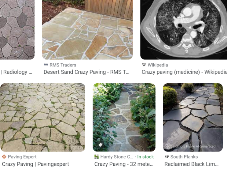 "Crazy paving" pattern in HRCT : 네이버 블로그