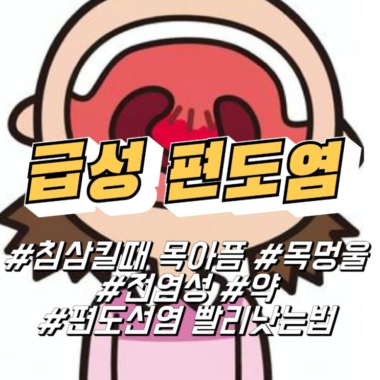 급성 편도선염 증상 및 빨리낫는법 침삼킬때 목아픔 목멍울 전염 약 네이버 블로그