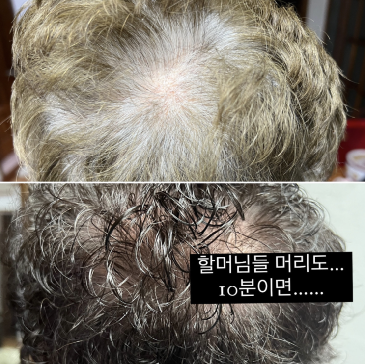 공구 거품 새치염색 샴푸 추천 자극0 자연유래성분 흰머리 염색하며 탈모개선 비듬균박멸 까지 네이버 블로그