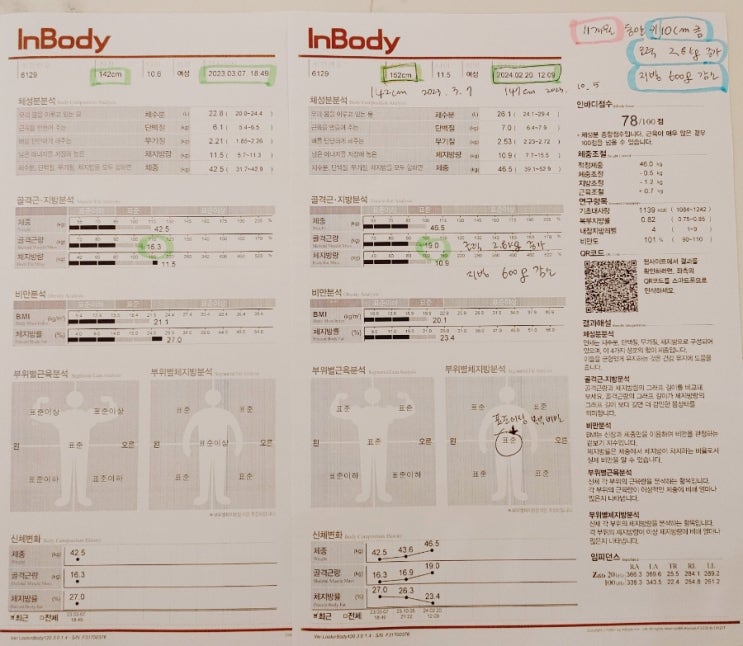 11개월에 10cm 크고 안짱다리 교정 했어요📢 자세교정 전문가 에스와이 스튜디오와 함께해요📢 방배동 이수역 청소년운동 내방역