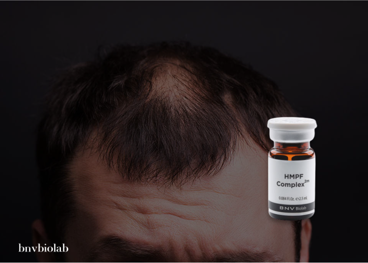 비엔뷔 바이오랩(BNV Biolab) HMPF 섬유아세포 모낭성장인자 안아픈 mts탈모 관리 : 네이버 블로그