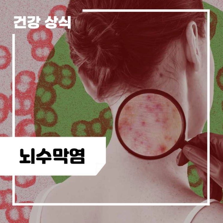 뇌수막염 증상 및 원인 검사 치료 예방접종 성인 신생아소아 네이버 블로그