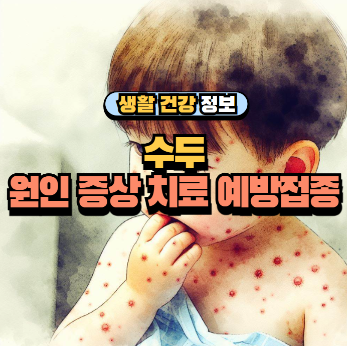 어린이 수두 감염 완치 초기 증상 재발 원인 증상 치료 방법 예방접종 네이버 블로그