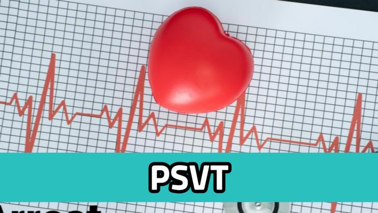 PSVT 상심실성빈맥 원인과 증상 심전도 특징 시술 치료 응급처치 발살바법 : 네이버 블로그