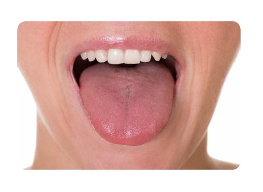 [강릉한의원-자연한의원] 구강작열감증후군(혀작열감)(Burning Mouth Syndrome, Glossopyrosis ...