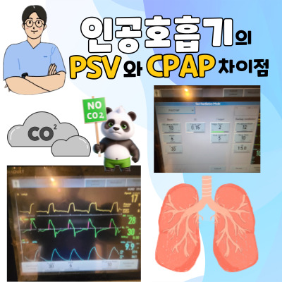 인공호흡기(Ventilator) PSV mode와 CPAP mode 차이점 : 네이버 블로그