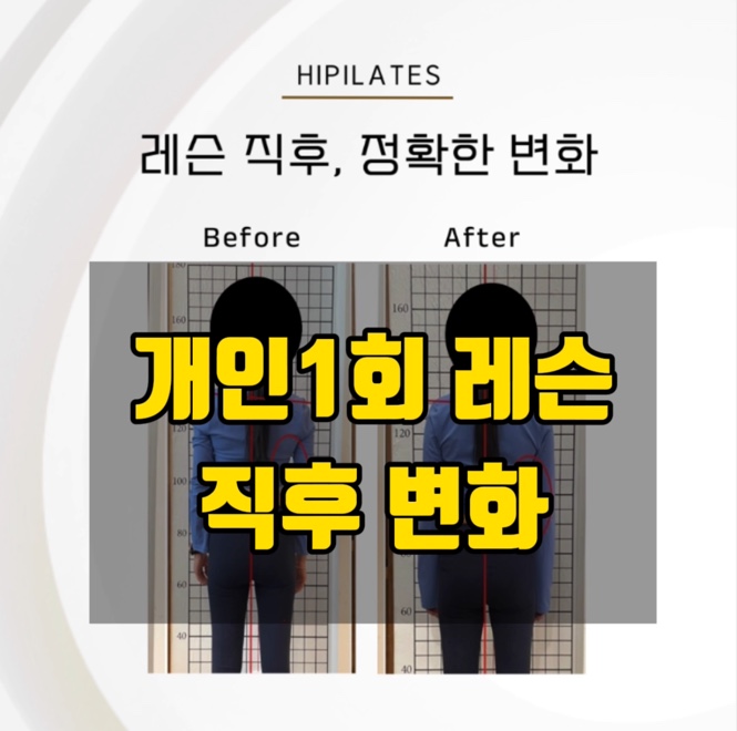 부천 은계지구 안녕필라테스 개인레슨 직후 체형변화후기 비포에프터골반틀어짐 척추측만증 어깨통증 무릎통증솔직한 리뷰