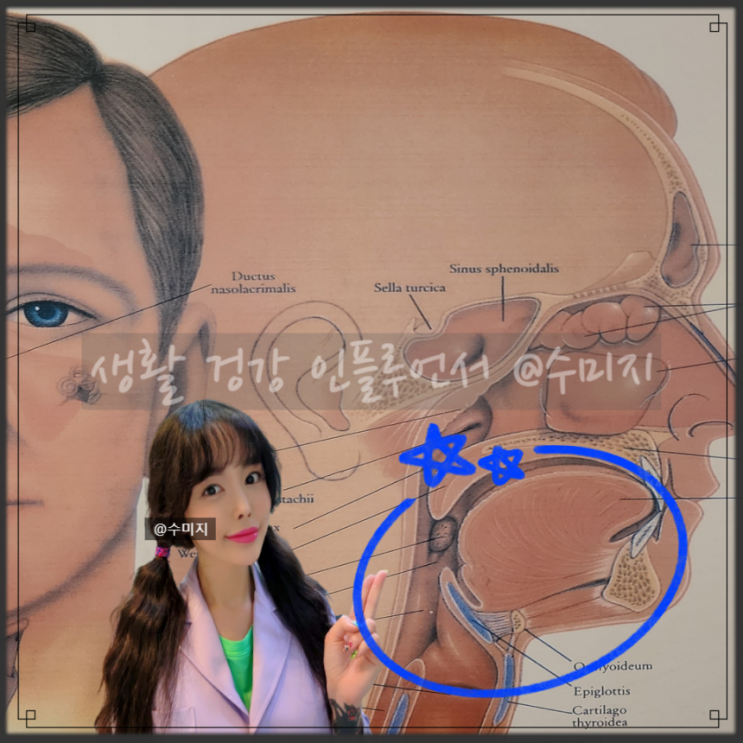 목이 타는 느낌 급성 인후염 증상 원인 만성 인후염 급성 후두염 네이버 블로그