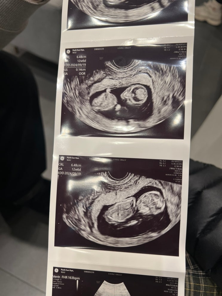 임신초기 안정기 8주차 ~13주차 임신기록 및 먹방일기 : 네이버 블로그