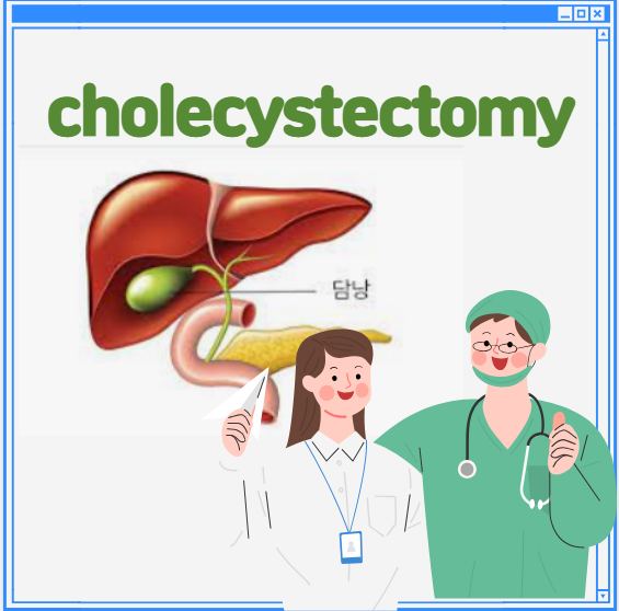 1. cholecystectomy/담낭염/담석증(정의) : 네이버 블로그