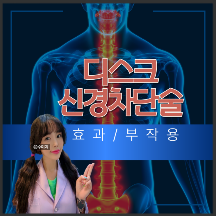 허리디스크 증상 치료 신경차단술 부작용 효과 요추 통증 경막외신경차단술 네이버 블로그