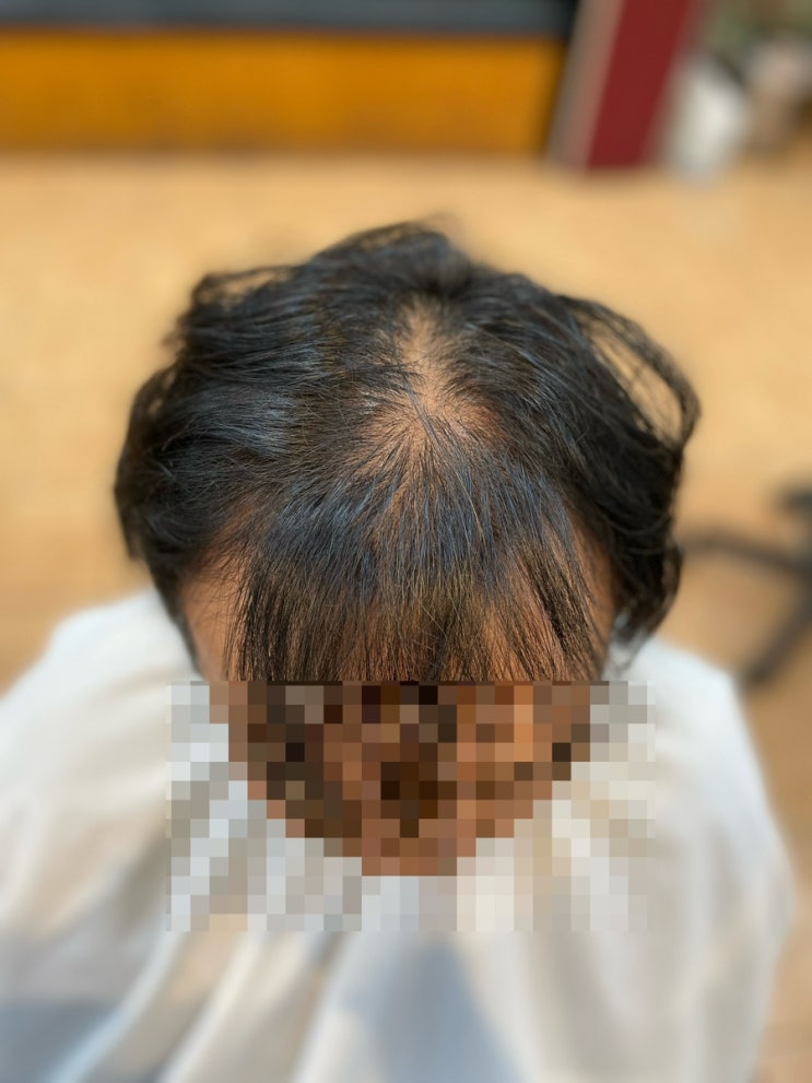 부산탈모 펌 나 혼자 풍성 사상구르네시떼미용실 탈모 컷 염색 클리닉 머리 잘하는 미용실 추천 헤어숍 네이버 블로그