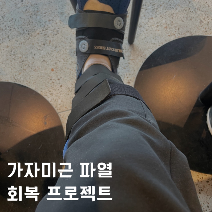 부상 리뷰 가자미근 파열 종아리 근육 파열 1일차 네이버 블로그