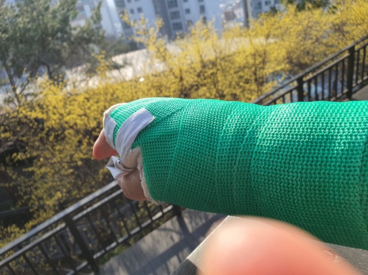 노후준비에 의료비통장 왜 만들지? 골절수술후53일 : 네이버 블로그