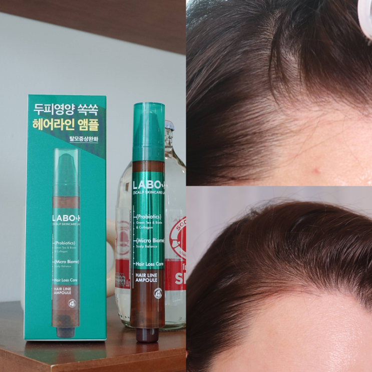 4월 올영픽 집에서 쉽게 두피관리 라보에이치 헤어라인앰플 올리브영 세일 추천템 네이버 블로그