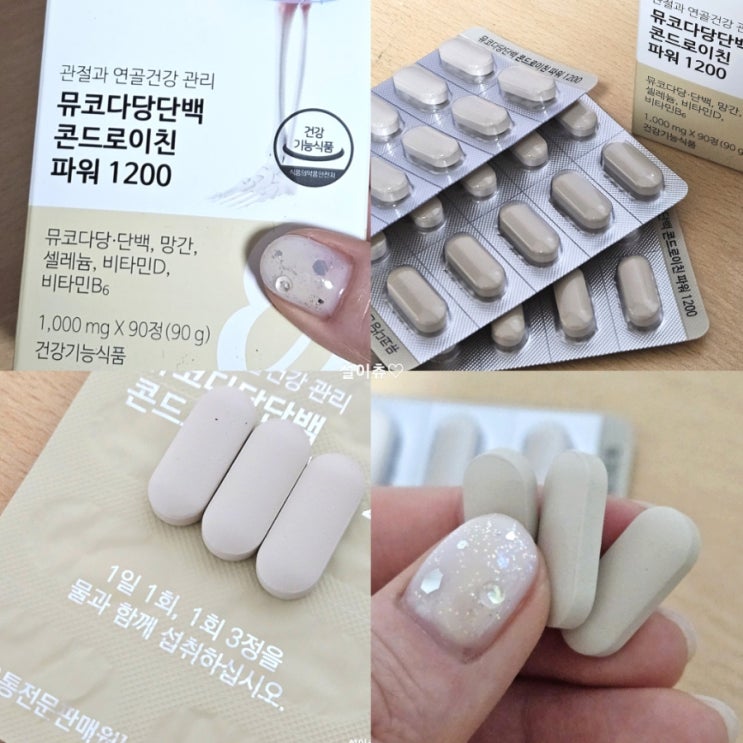 70대 할머니 선물 무릎 연골에 좋은 관절영양제 추천 콘드로이친 무릎 연골 영양제 네이버 블로그