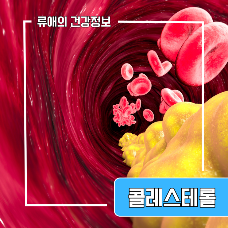 총 콜레스테롤낮추는방법 및 Ldl 콜레스테롤낮추는음식 정리 네이버 블로그