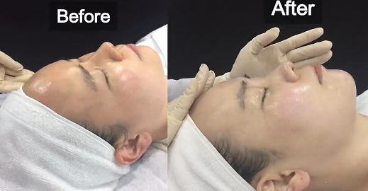 퓨리영 크라이오 멀티마스터/CRYO MULTI MASTER/7가지 기능을 한 번/일렉트로포레이션(MTS)/크라이오 냉동요법 ⋅ ...