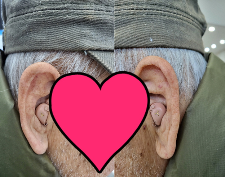 중랑구 보청기 중화동 심하지 않은 청각장애 아버님의 충전식 귓속형 보청기 착용 네이버 블로그