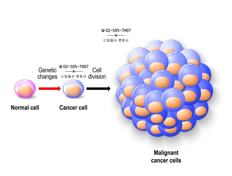 D47.1, D47.3, D47.4, D47.5는 악성종양 : 네이버 블로그