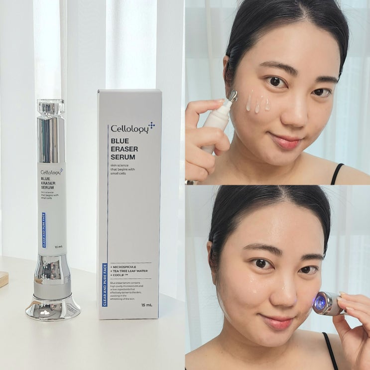 얼굴 좁쌀여드름 화장품 블루led세럼 추천 후기 네이버 블로그