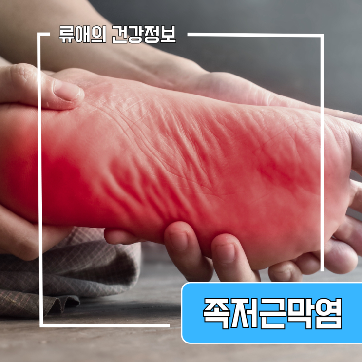 발바닥 족저근막염 초기증상 원인 치료 방법 족저근막염스트레칭 네이버 블로그