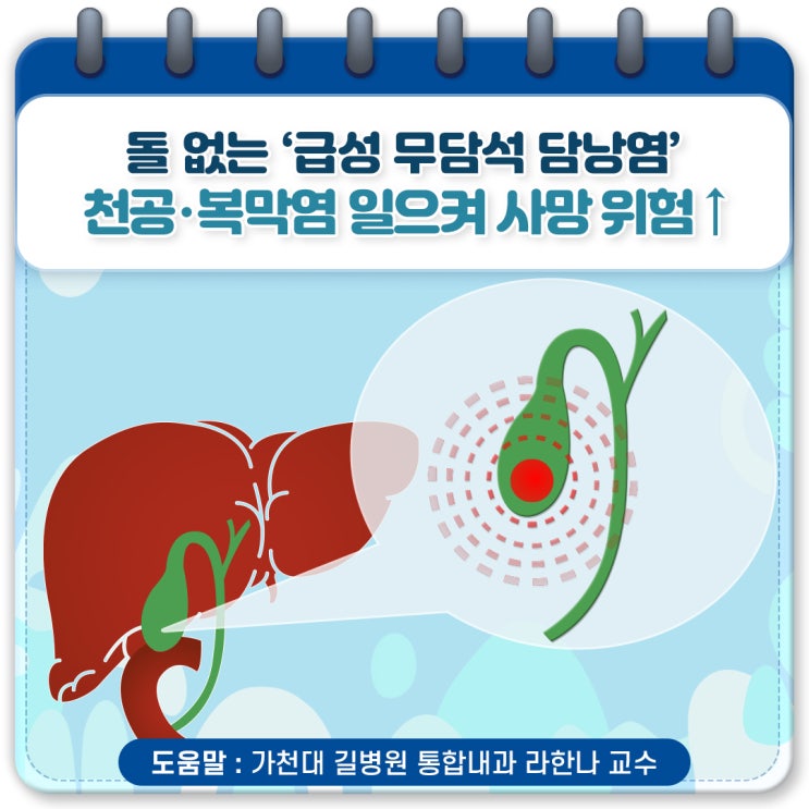 돌 없는 ‘급성 무담석 담낭염 천공‧복막염 일으켜 사망 위험↑ 네이버 블로그