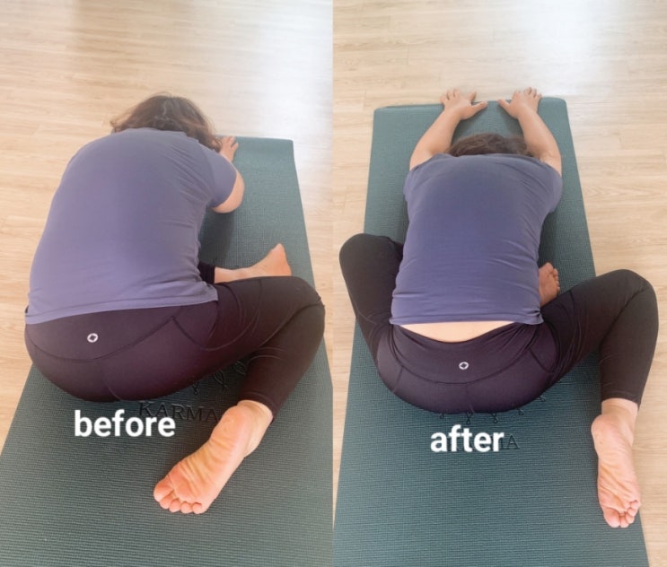 청주 내덕동soo yoga에서 #골반교정" 변화모습으로 라인이 이뻐졌어요!before/after변화모습거북목,굽은등 까지 놀라운 ...
