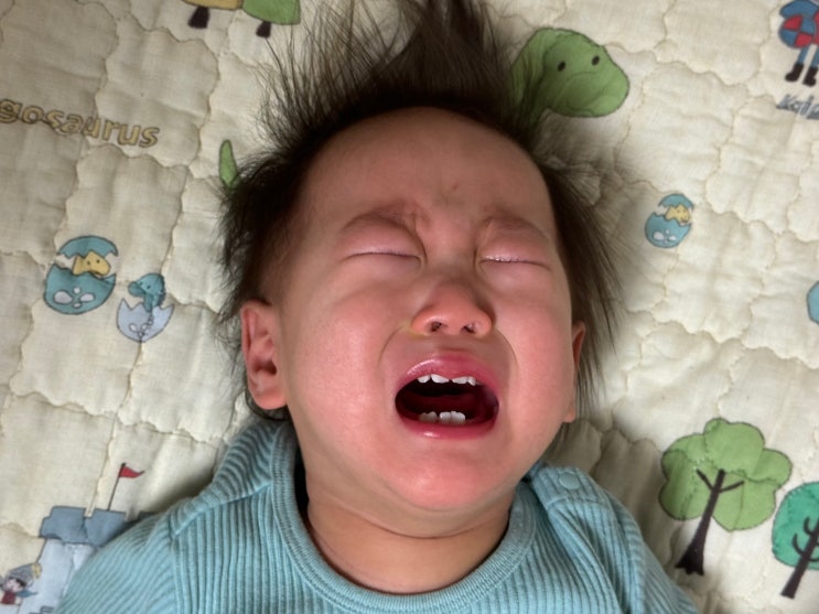 상순소대 아기 순소대 찢어짐 대처방법 수술 절제술 하는 이유 네이버 블로그