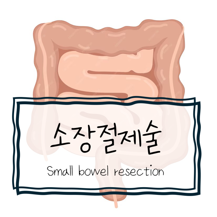 [OR] 소장절제술(small bowel resection)의 방법 : 네이버 블로그