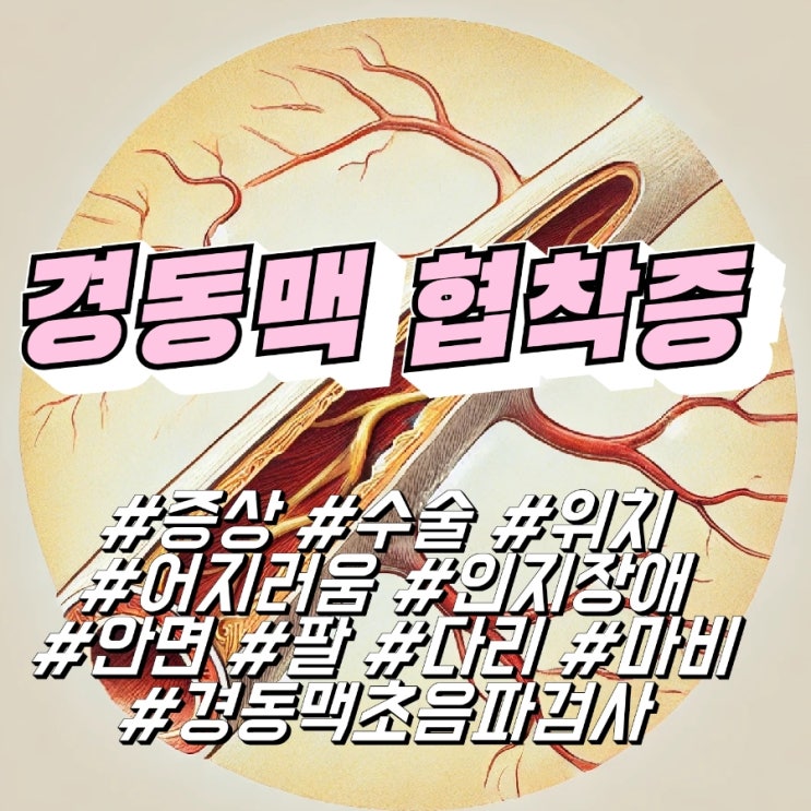 경동맥 협착증 수술 위치 경동맥초음파 검사 어지러움 인지장애 안면 마비 팔 다리마비 증상 네이버 블로그
