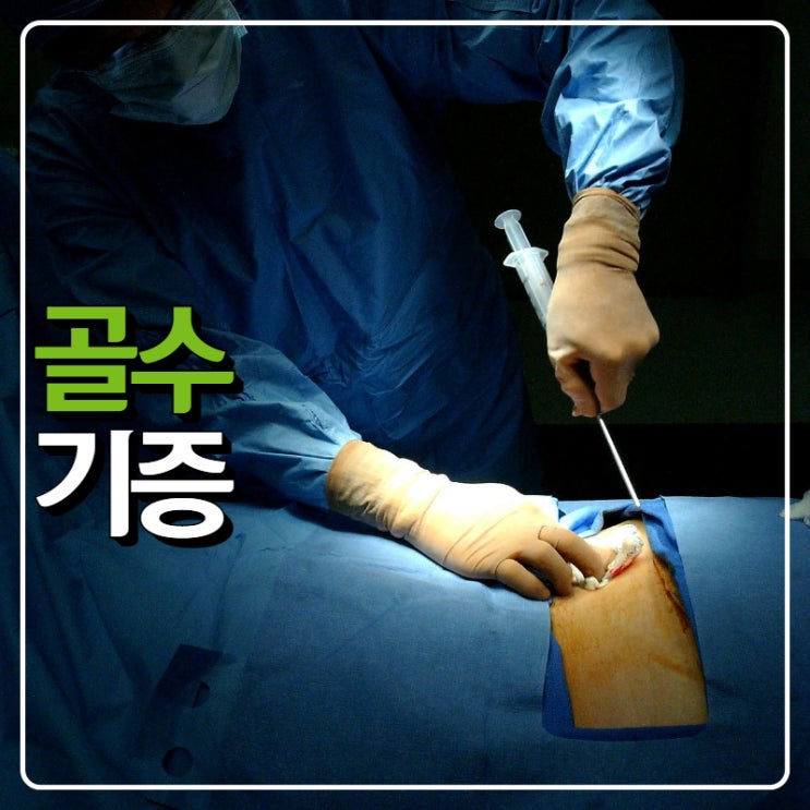 골수이식과 조혈모세포이식 기증 방법 부작용 알아보기 네이버 블로그