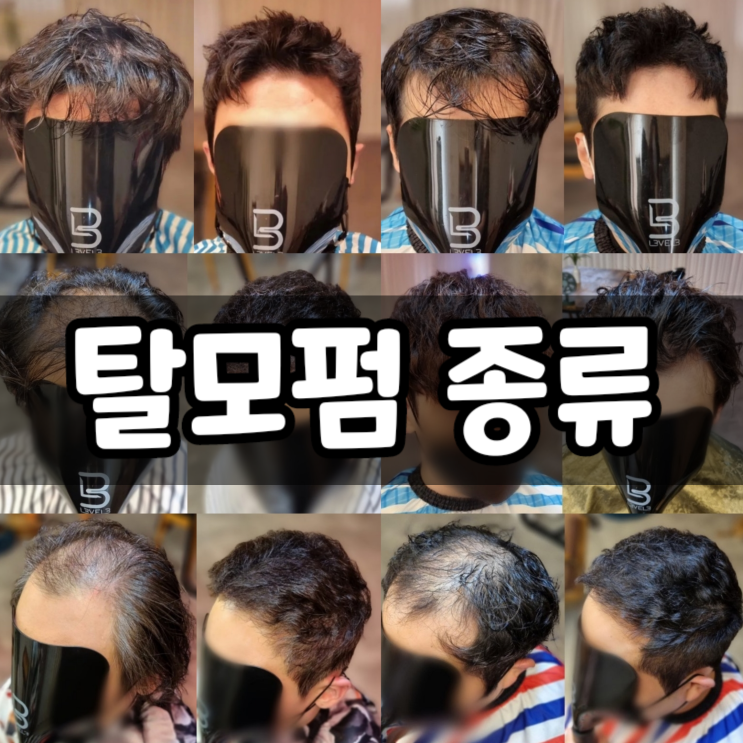 부평탈모성지 남자파마 종류 탈모펌 종류 탈모스핀스왈로펌 뿌리스왈로 엠자탈모펌 정수리탈모커버펌 인천더블앤스핀 탈모 헤어스타일