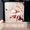 아기 초음파 사진 보는법 주수사진 입체초음파 용어정리 네이버 블로그