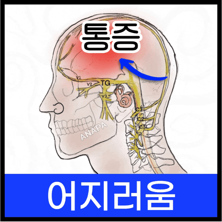 자고 일어나면 두통 혹은 어지러움 지속될 때 치료 네이버 블로그