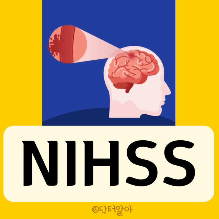 NIHSS의 정의, 구성, 해석, 주의사항, 한계 : 네이버 블로그