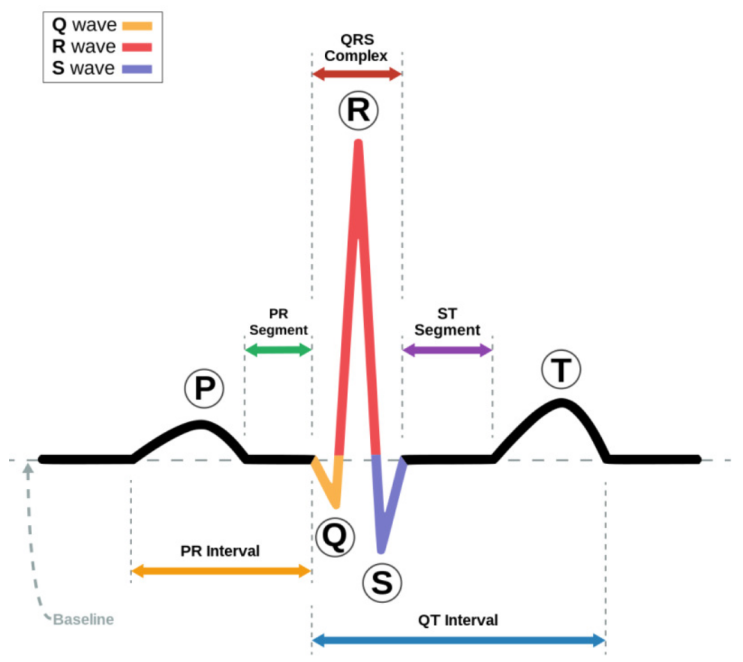ECG(EKG, 심전도) 파형(waveforms)의 구성 요소: P파, QRS complex, T파 : 네이버 블로그